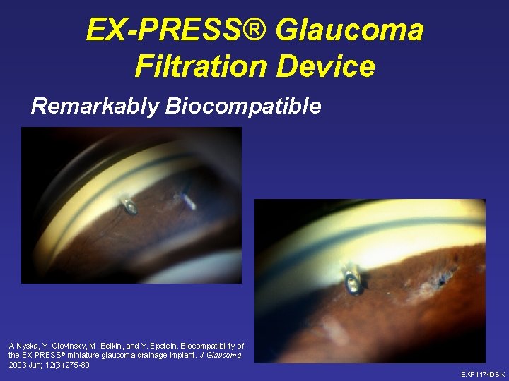 Glaucoma Surgery 2011 Why am I Still Doing