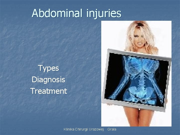 Abdominal injuries Types Diagnosis Treatment Klinika Chirurgii Urazowej