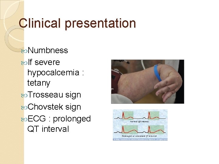 Parathyroid disorders Calcium metabolism physiology of calcium homeostasis