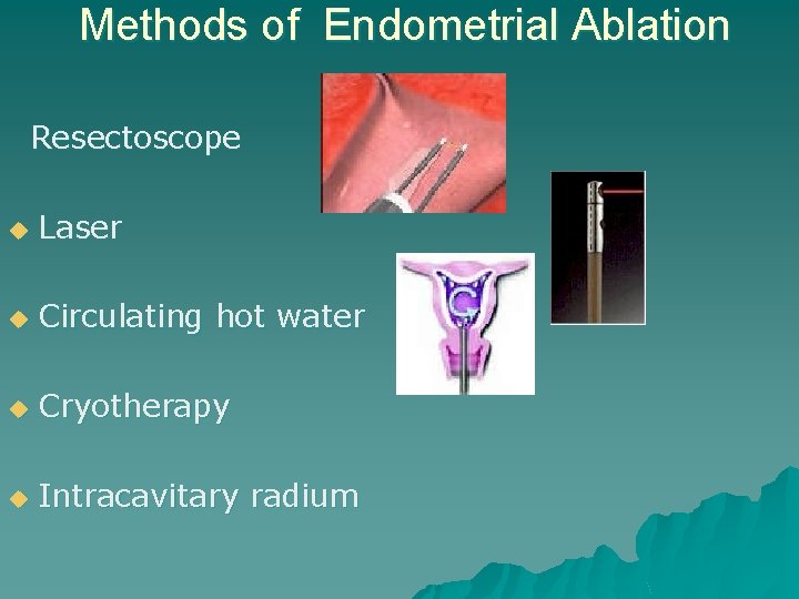 Balloon in uterus Instead of Hysterectomy MTBEA Dr