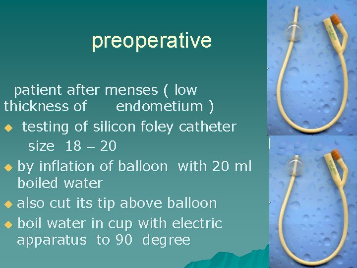 Balloon in uterus Instead of Hysterectomy MTBEA Dr