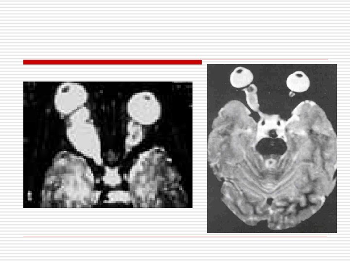 MRI 3 MRI o Magnetic resonance imaging MRI