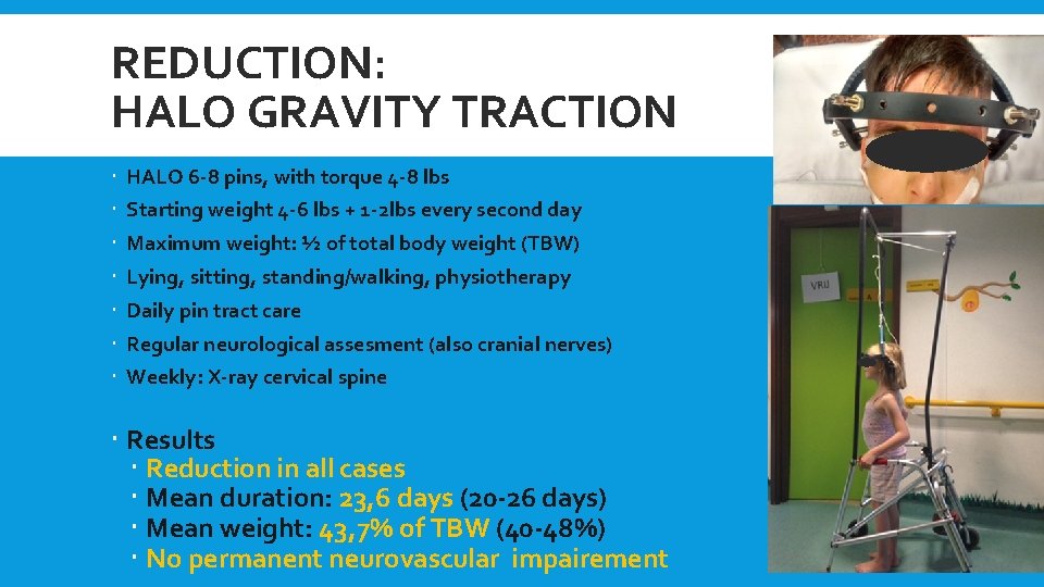 TREATMENT OF NEGLECTED ATLANTOAXIAL ROTATORY DISPLACEMENT FRANSEN N