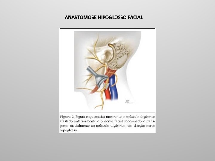SEMITICA NEUROLGICA ADRIANO YACUBIAN FERNANDES SEMIOLOGIA E NEUROLOGIA