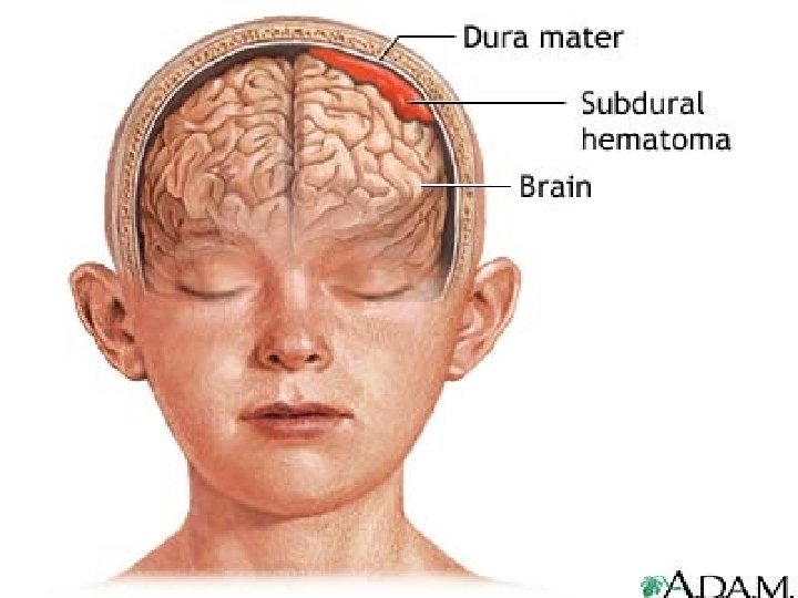Evaluation management of head injured patient Classification of