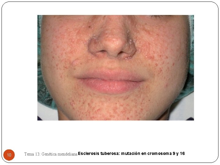 Gentica mendeliana 2 Tema 13 Gentica mendeliana Retrocruzamiento