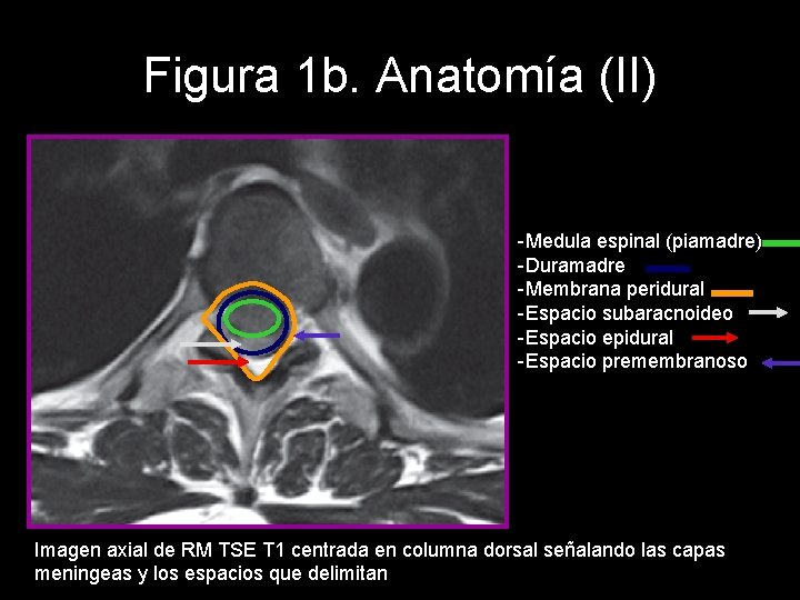Introduccin Para realizar el diagnstico diferencial de las
