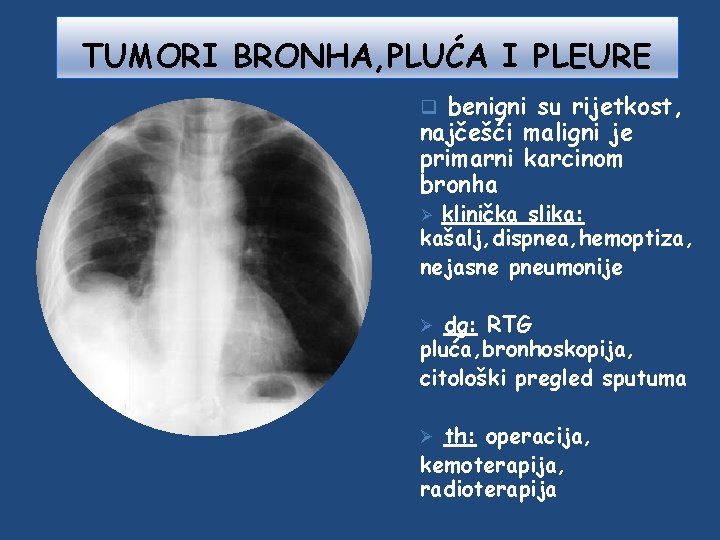 PRIJEOPERACIJSKA PRIPREMA BOLESNIKA ZA OPERACIJU NA PRSNOM KOUPLUIMA
