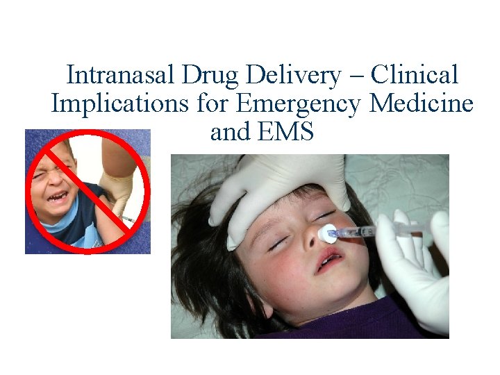 Intranasal Drug Delivery Clinical Implications for Emergency Medicine
