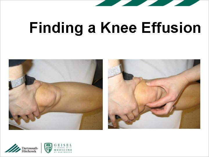 Knee Examination in Context Some Anatomy and History