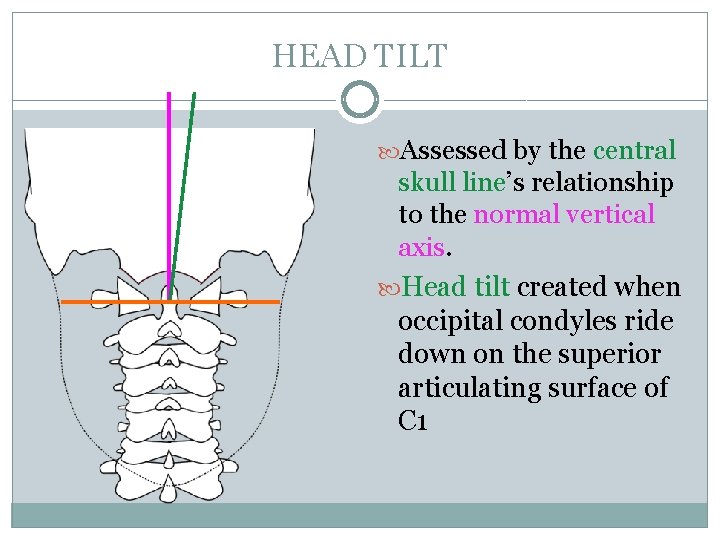 Intro to Biomechanics NUCCA PROTOCOLS AND PERSPECTIVES A