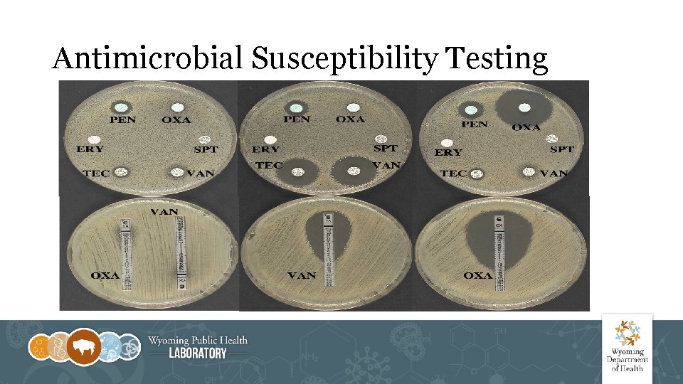 Microbiology Tests What do They Mean Shawna Dereemer