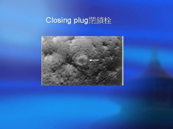 Cleavage and implantation Day 1 Day 14 http