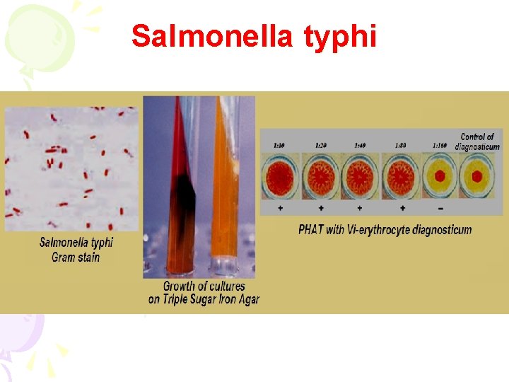 Enterobacteria Biological characteristic and classification of genera ...