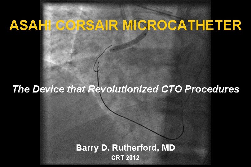 ASAHI CORSAIR MICROCATHETER The Device that Revolutionized CTO