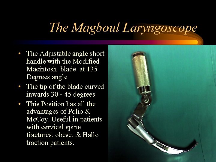 THE MAGBOUL LARYNGOSCOPE The Magboul Laryngoscope The PatilSyracuse