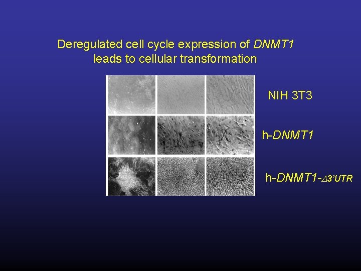 Cell cycle regulation of DNMT 1 and cancer