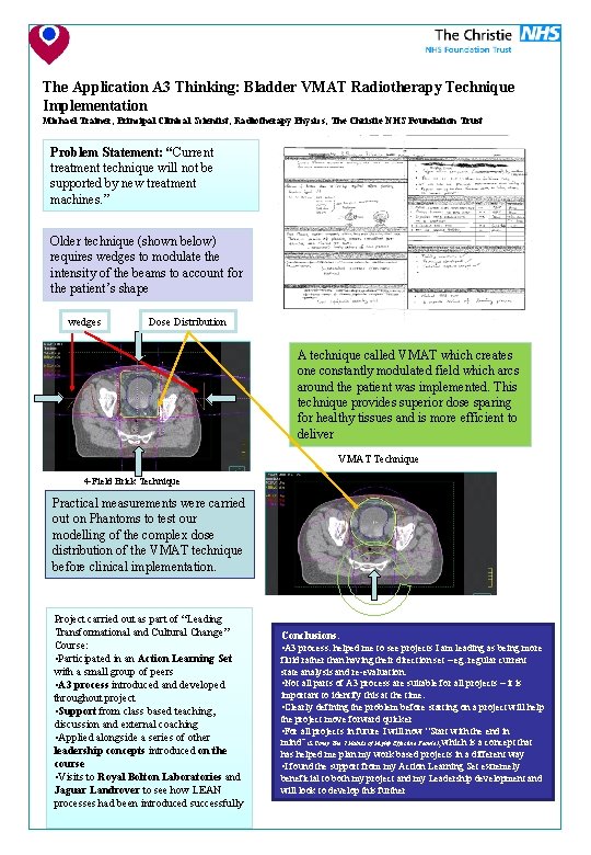The Application A 3 Thinking Bladder VMAT Radiotherapy