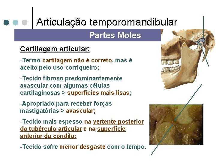 Articulao temporomandibular Ana Cristina Antunes Articulao ...