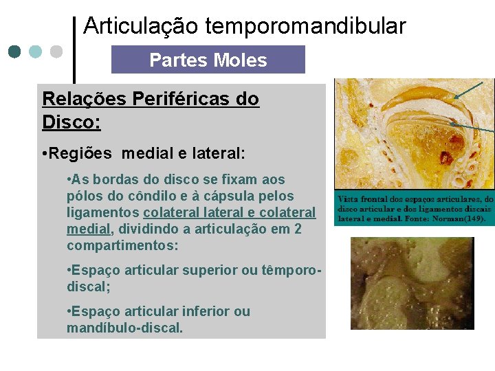 Articulao temporomandibular Ana Cristina Antunes Articulao ...