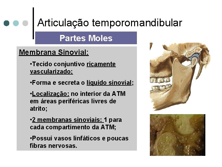 Articulao temporomandibular Ana Cristina Antunes Articulao ...