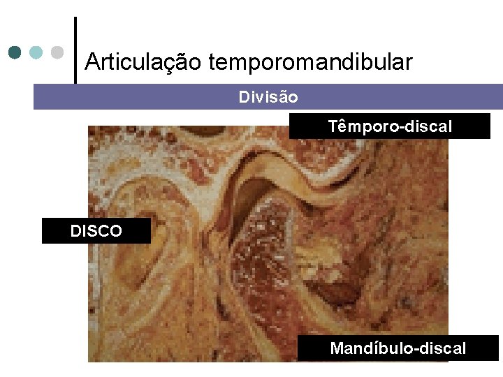 Articulao temporomandibular Ana Cristina Antunes Articulao ...