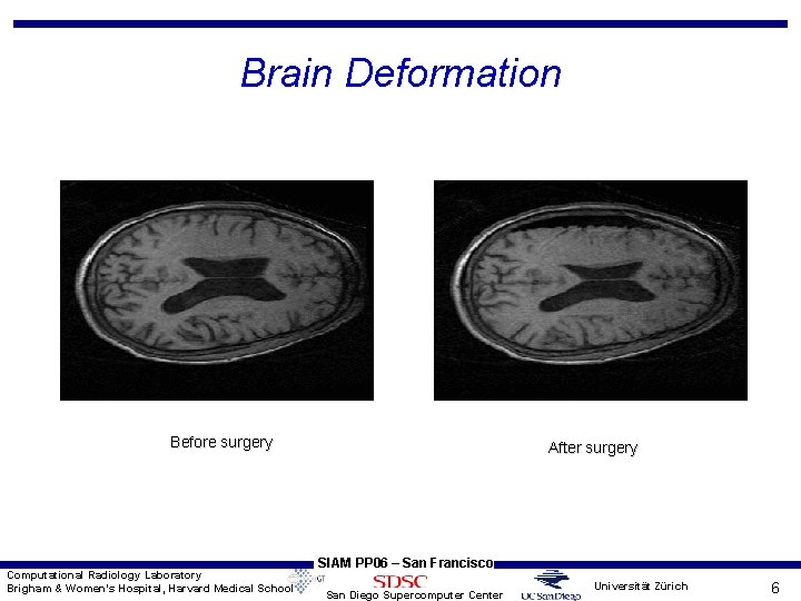 Dynamic Data Driven Finite Element Modeling of Brain