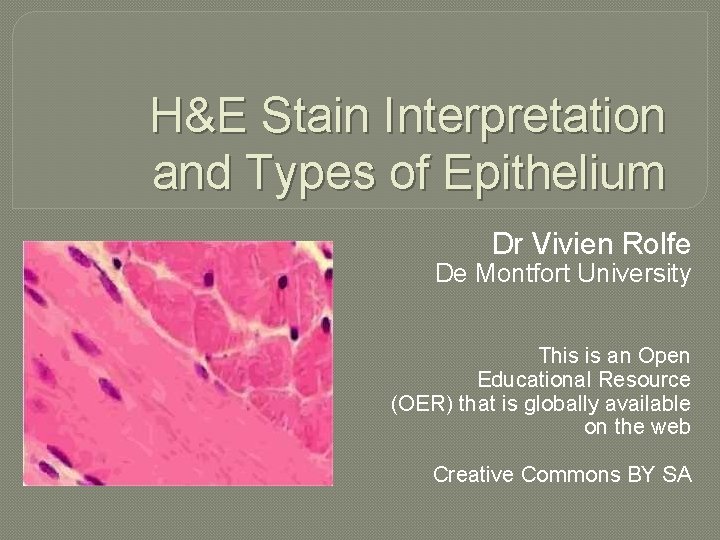 HE Stain Interpretation and Types of Epithelium Dr