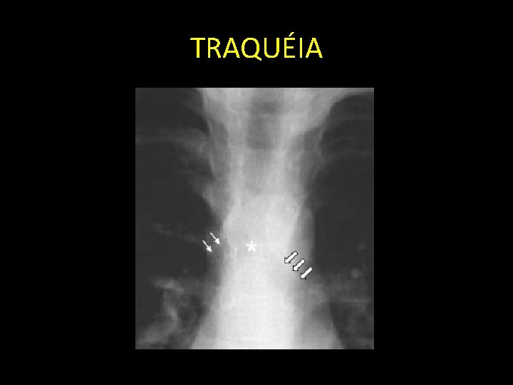 RADIOGRAFIA DE TRAX NO PS Liga Acadmica de