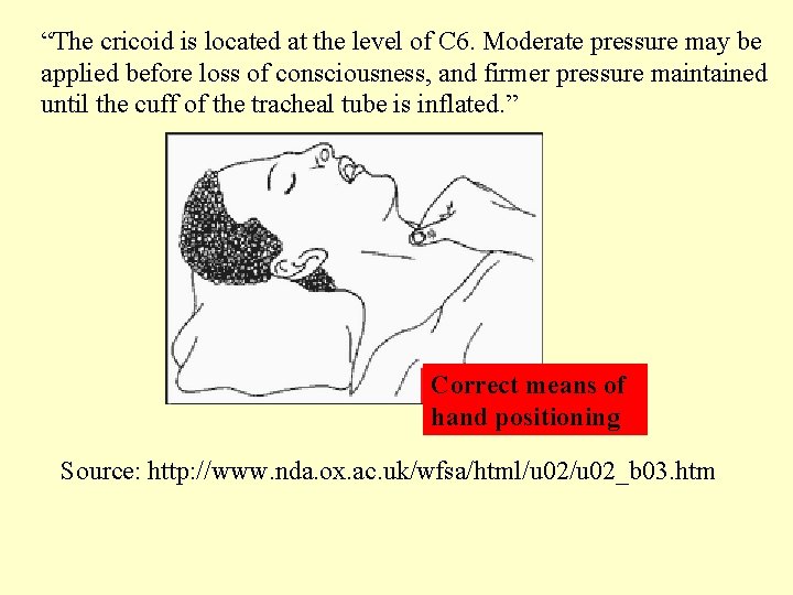 Making The Case for Cricoid Pressure D John