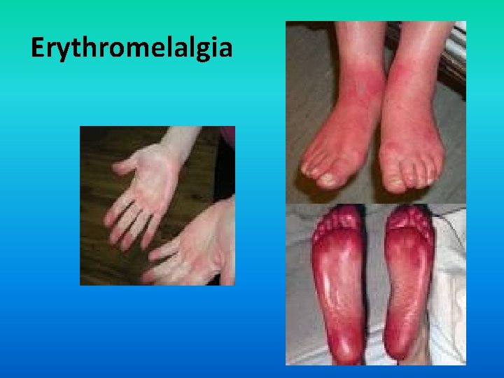 Ergot Alkaloids Dr Naila Abrar LEARNING OBJECTIVES After