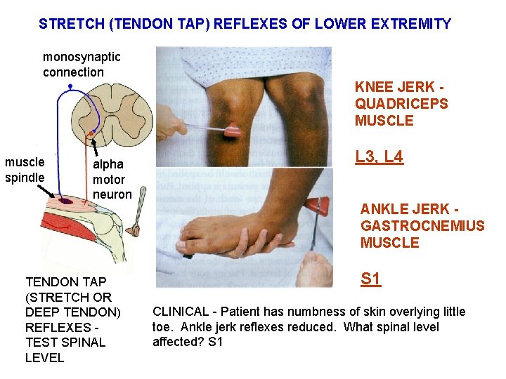 REVIEW OF LOWER EXTREMITY FOR BOARD EXAMS 2014