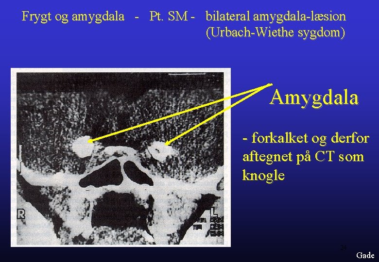 Emotioner isr frygt amygdala og det limbiske system