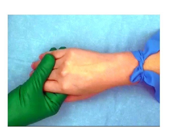 Peripheral Vein Catheterization Indication Drug administration ...