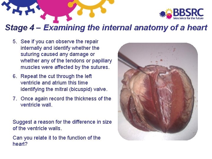 Heart Surgery and Dissection Keywords courtesy of www