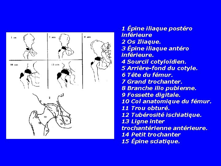Cenni di anatomia Cenni di anatomia Coxa Valga