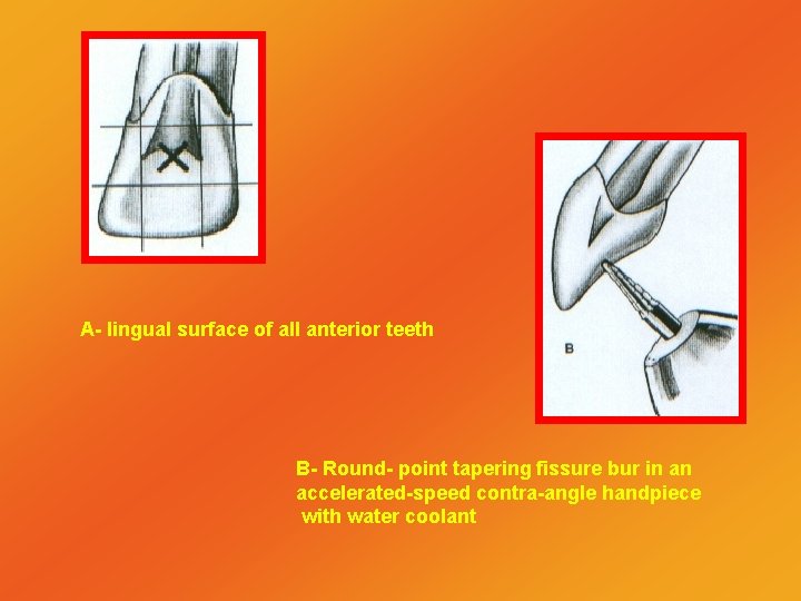 A lingual surface of all anterior teeth B