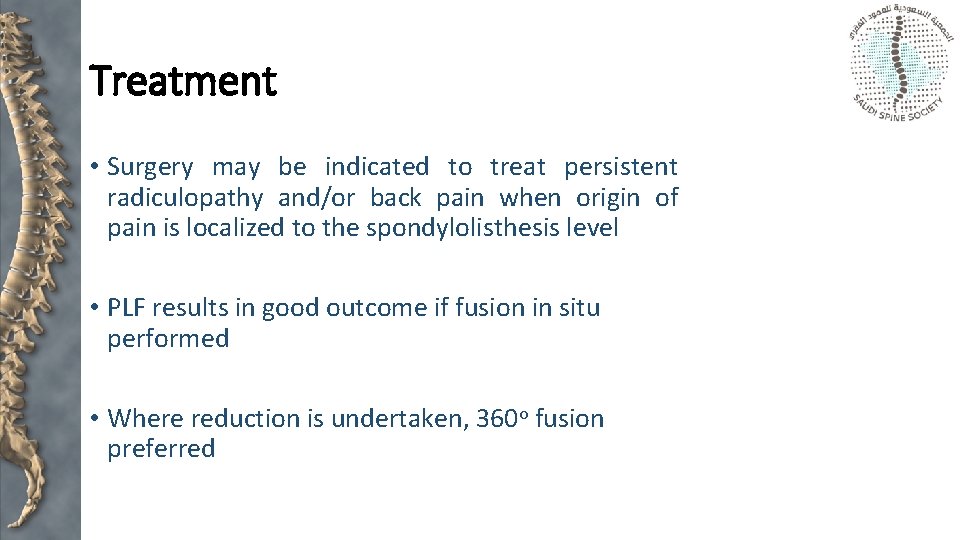 Spine made easy Spondylolisthesis Waleed Awwad MD FRCSC