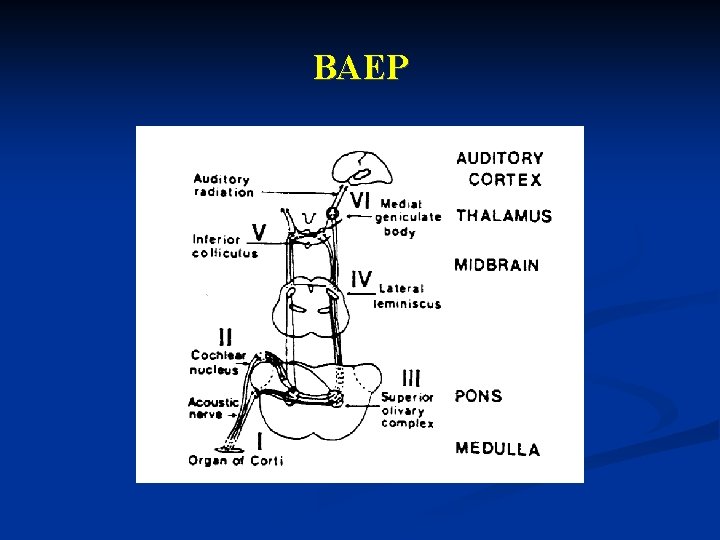 Posterior Fossa Procedures Infratentorial Craniotomy and ...