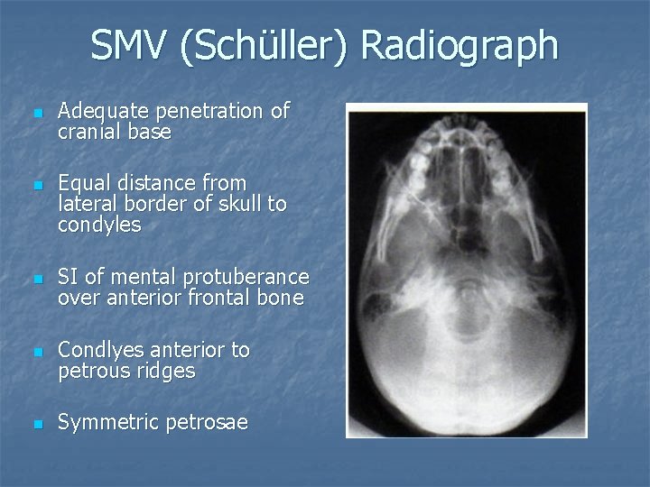 Cranium RTEC 233 Fall 2008 Week 1 2