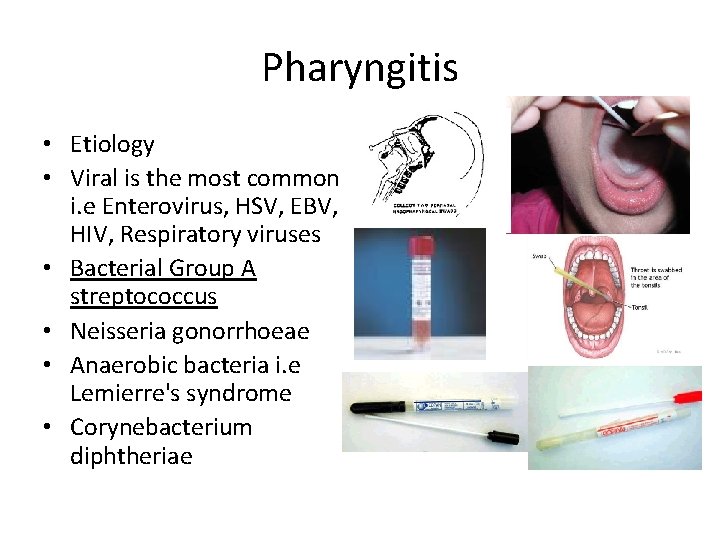 Upper Respiratory Tract Infection URTI Dr fawzia Alotaibi