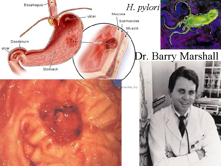 How can we efficiently and effectively obtain valid