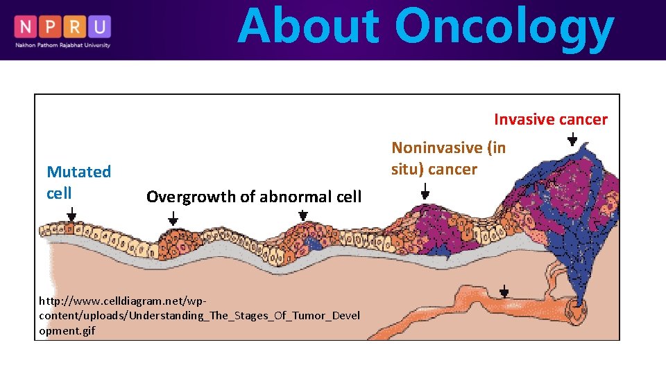 Lesson 3 Oncology Unit Case information Breast Cancer