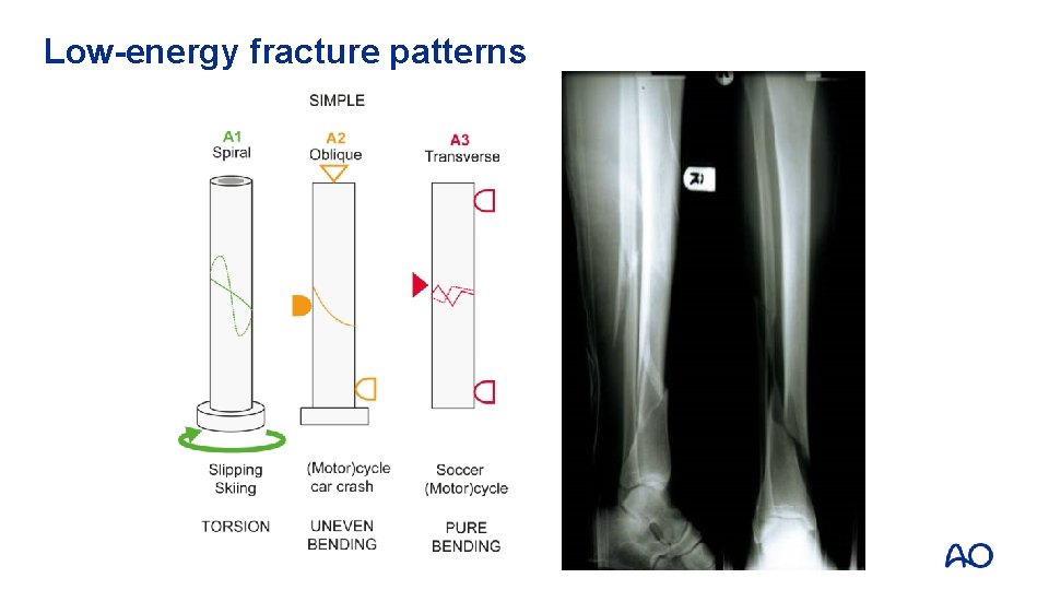 The softtissue injury a high priority consideration AO