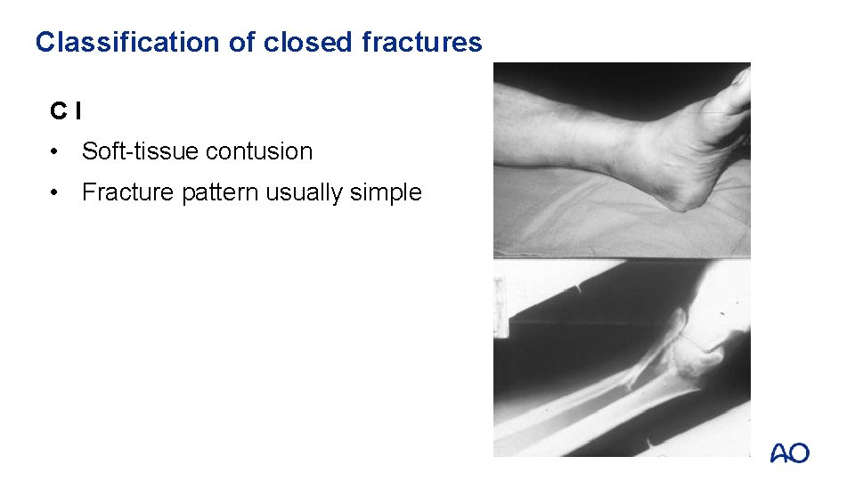 The softtissue injury a high priority consideration AO