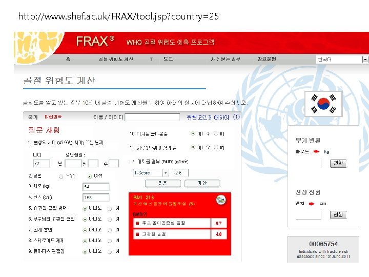 Osteoporosis Osteopenia 2015 09 07 Osteoporosis Osteoporosis is