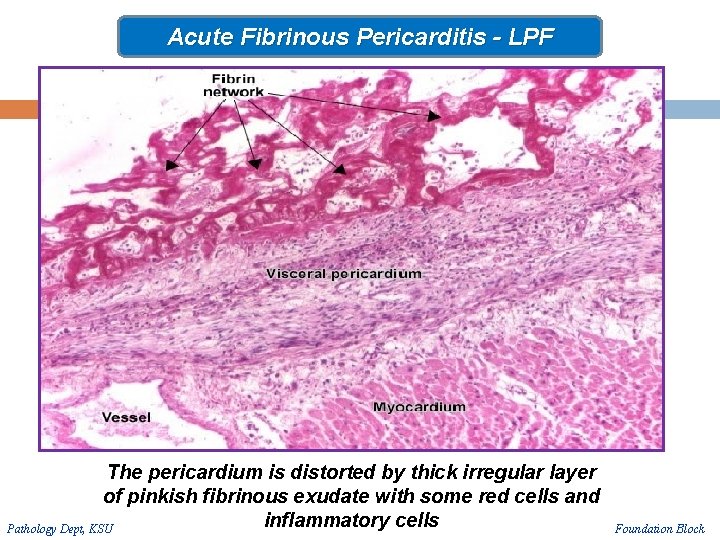 PRACTICAL 2 CELL INJURY INFLAMMATION II I Acute