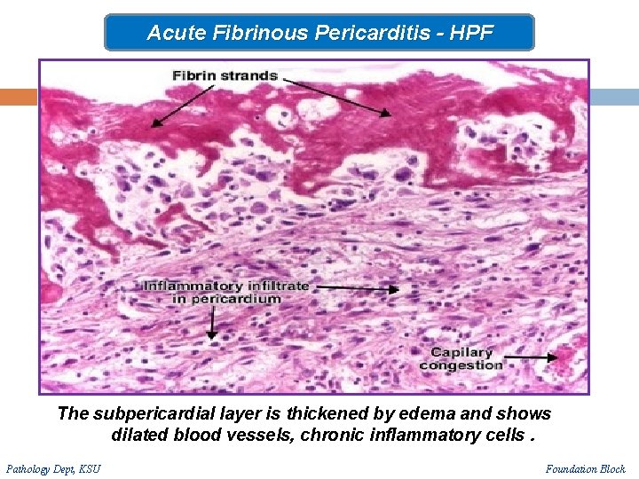 PRACTICAL 2 CELL INJURY INFLAMMATION II I Acute