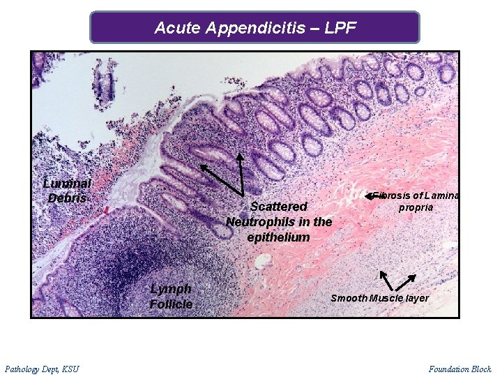 PRACTICAL 2 CELL INJURY INFLAMMATION II I Acute
