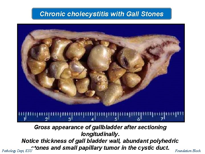 PRACTICAL 2 CELL INJURY INFLAMMATION II I Acute